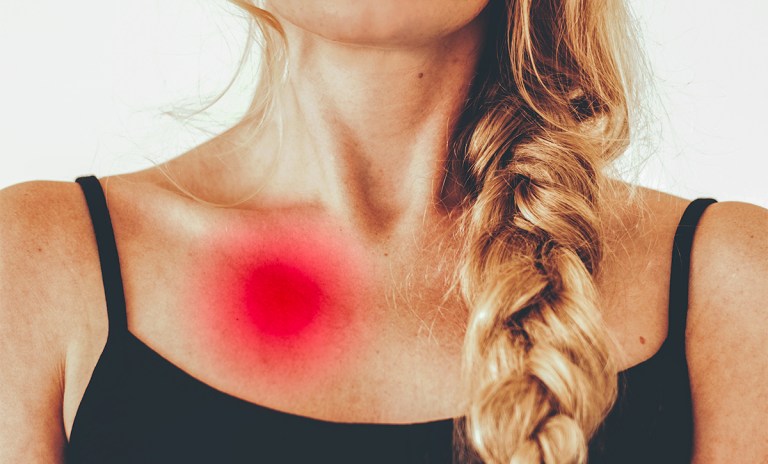 What is the Keto Rash? The Reason Behind the Itch